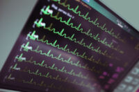 What Are The Stages Of Congestive Heart Failure? When To Go To The ...